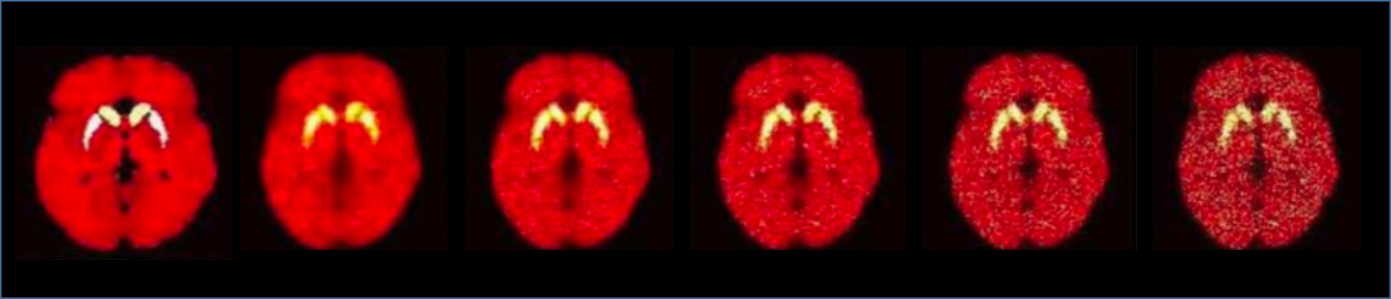 Brain PET Sim + Recon – NMMItools