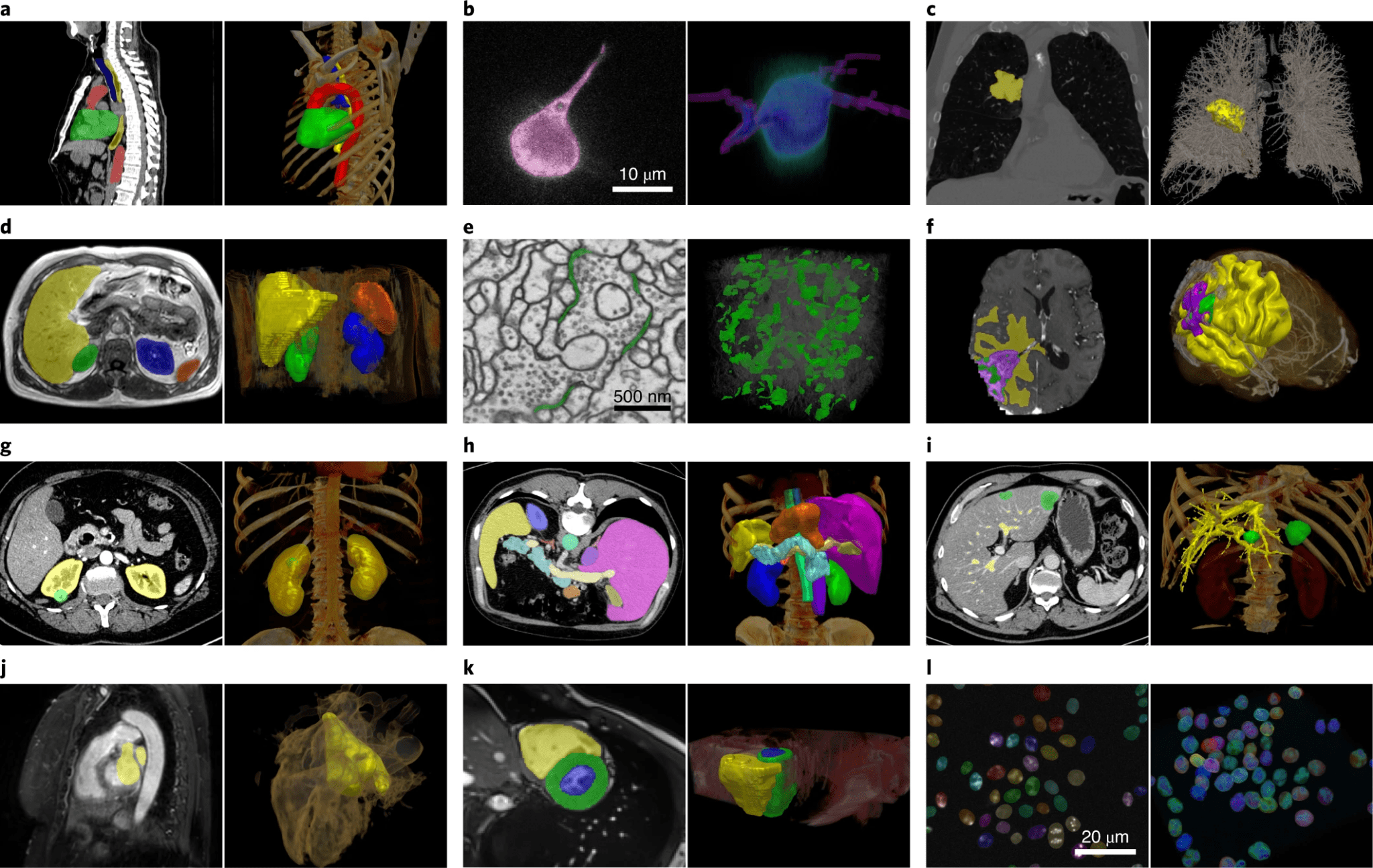 nnU-Net: a self-configuring method for deep learning-based biomedical ...