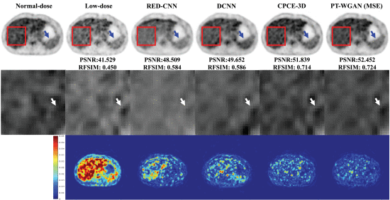 Parameter-Transferred Wasserstein Generative Adversarial Network (PT-WGAN) for Low-Dose PET ...