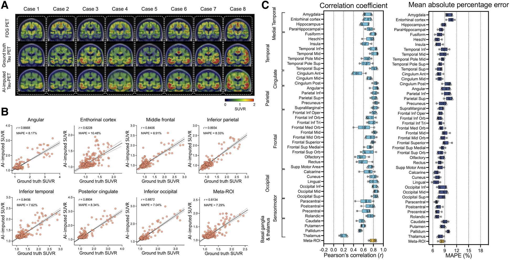 AI-imputed tau-PET: Synthesizing PET images of tau pathology from cross ...